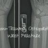Prolia for Bone Fractures — I’m Still Not Impressed - Better Bones ...