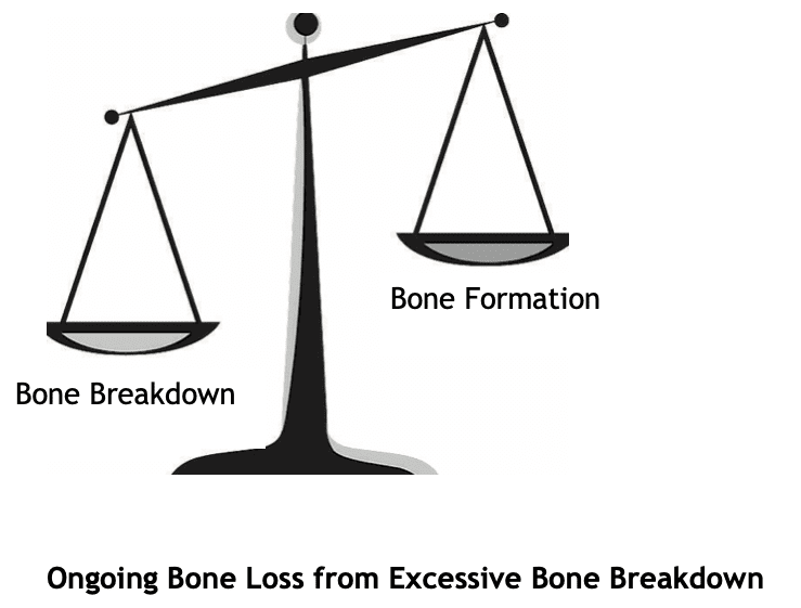 Causes Of Osteoporosis — Better Bones