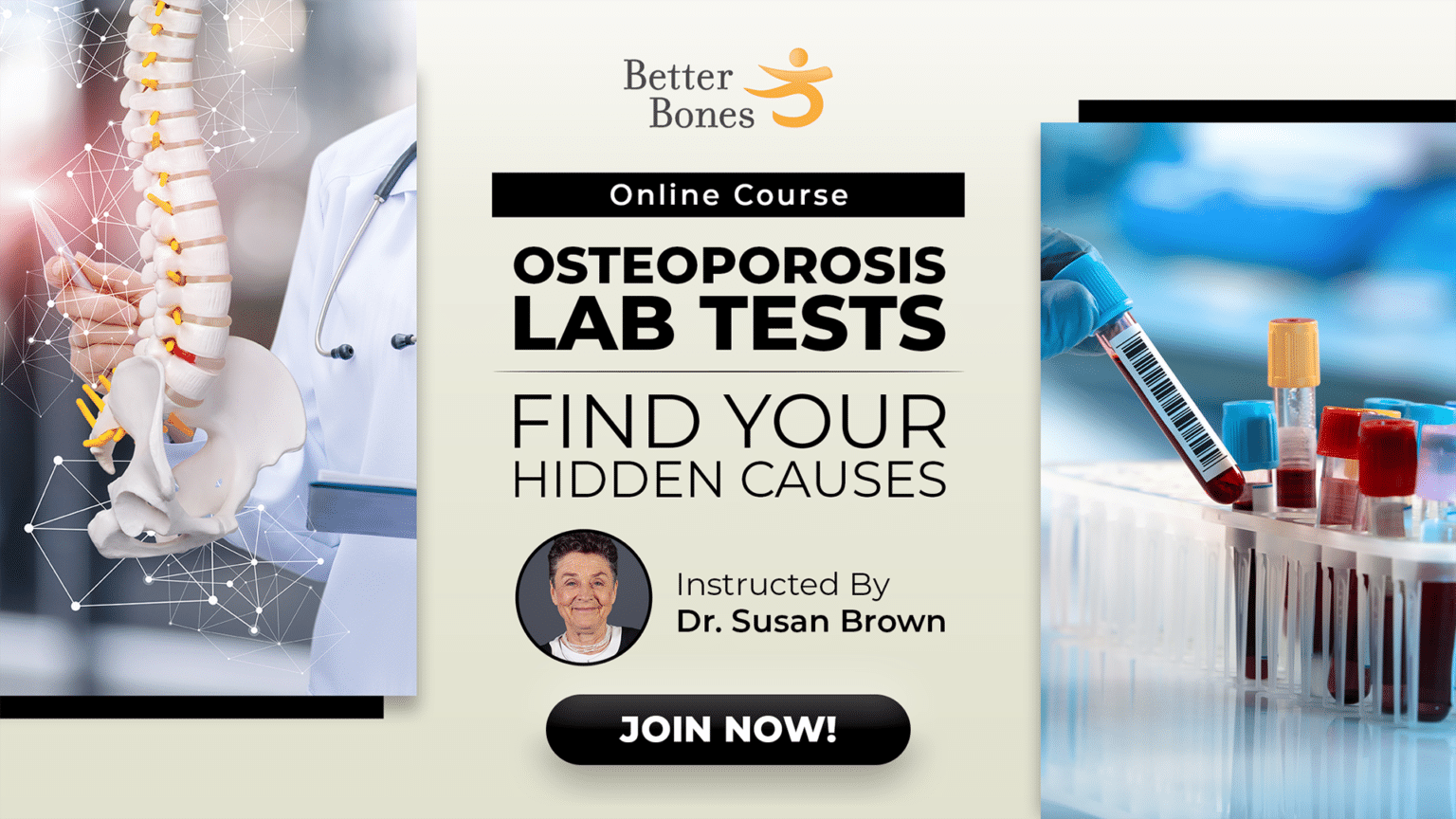 Bone Health Videos - Better Bones, Better Body