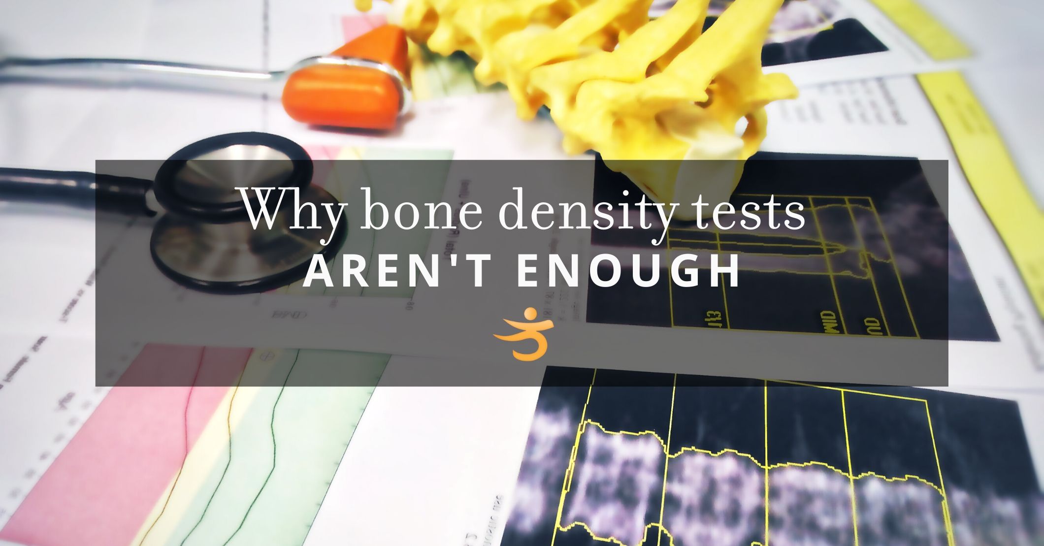 Bone density tests aren’t enough — why a Fracture Risk Assessment is ...